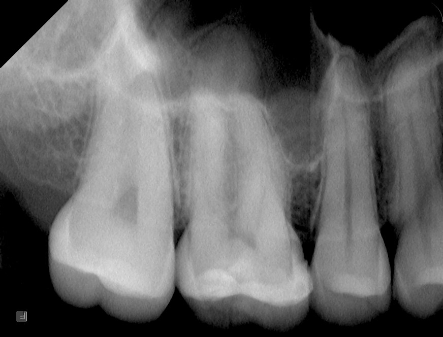 Ortopan | 2D slikanje zob | RTG studio Sever | Maribor